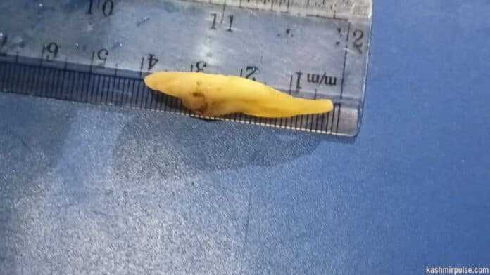 Worlds Biggest Human Tooth US Man Sets World Record For Tongue As Big